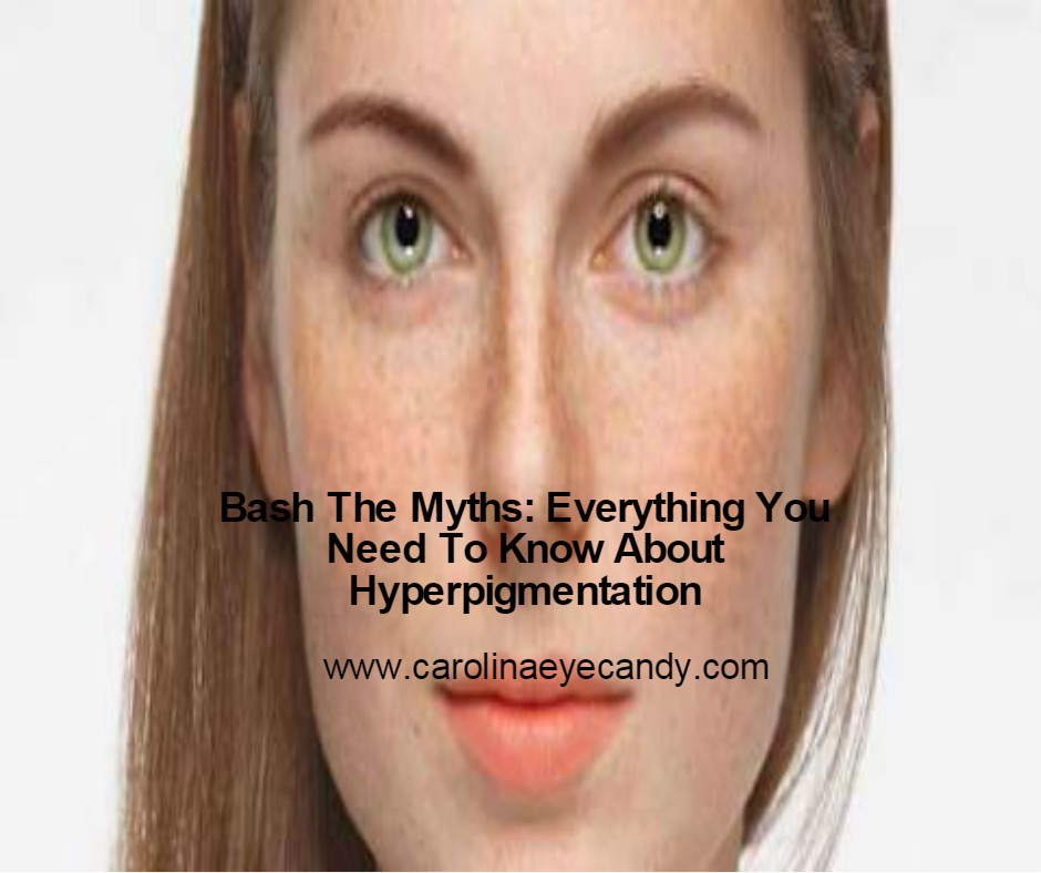 Bash The Myths: Everything You Need To Know About Hyperpigmentation ...